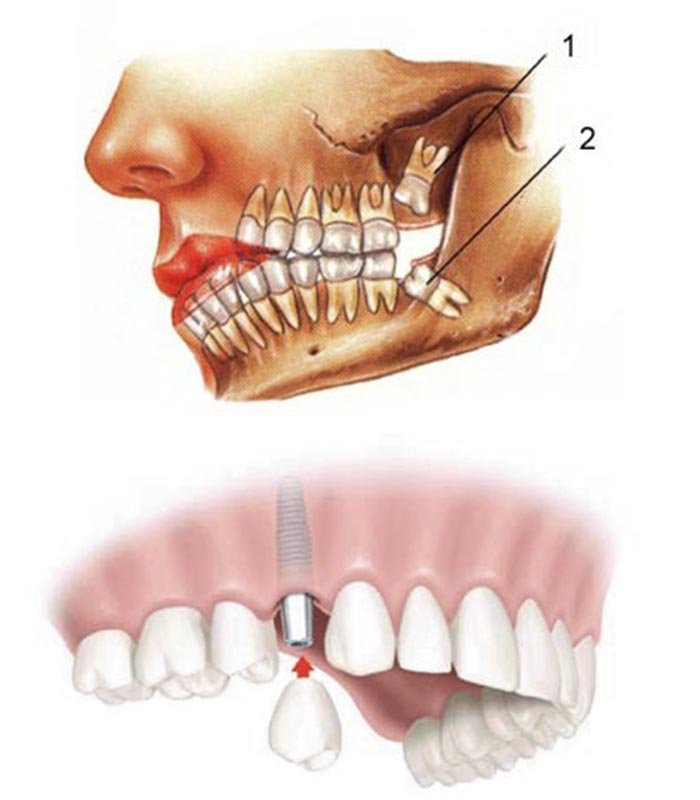 ORAL AND MAXILLOFACIAL SURGERY - GT DENTAL CARE